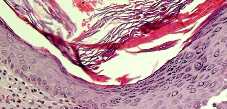 Center for Dermatologic Diseases